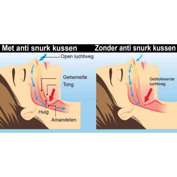 Anti-snurk traagschuim kussen kopen?